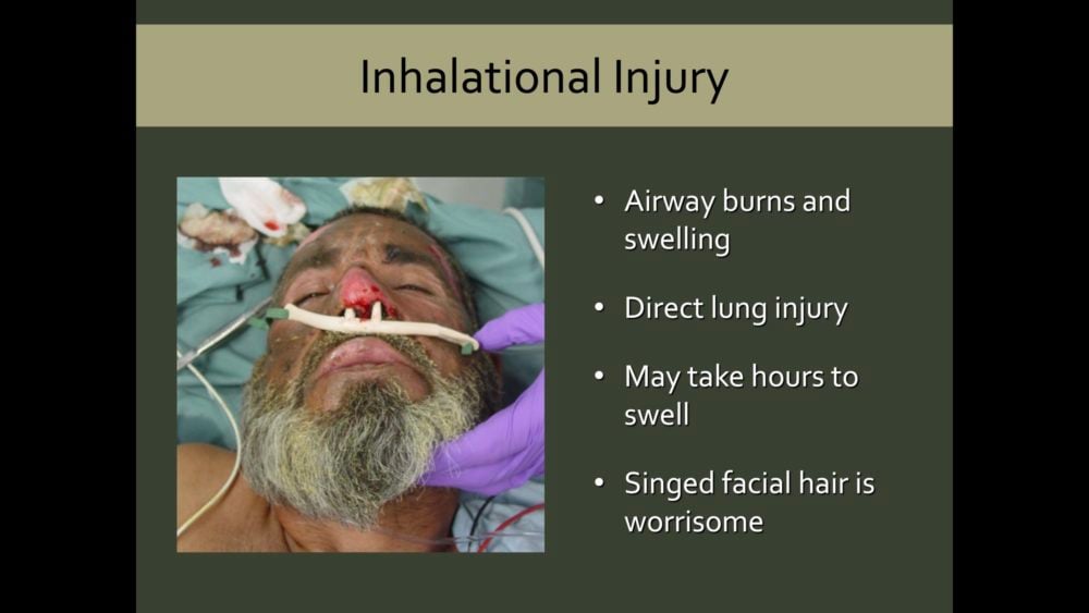 Inhalation Burns Inhalation Burns