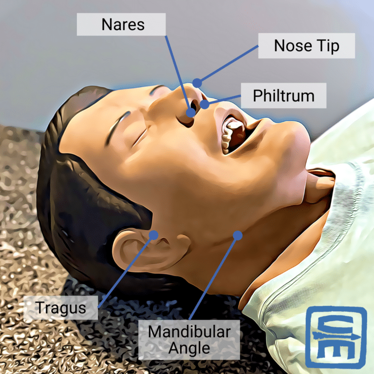 Using facial features for proper sizing of an NPA? - Crisis Medicine